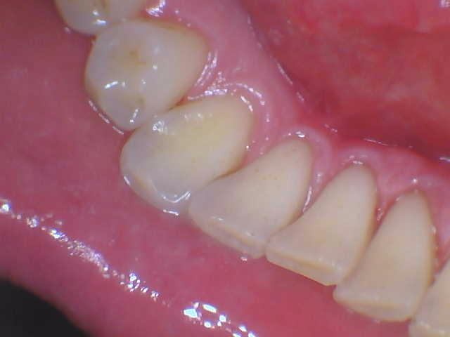 About Us Before and After Gallery Before and After Before and After ...