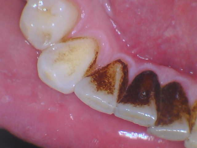 About Us Before and After Gallery Before and After Before and After ...